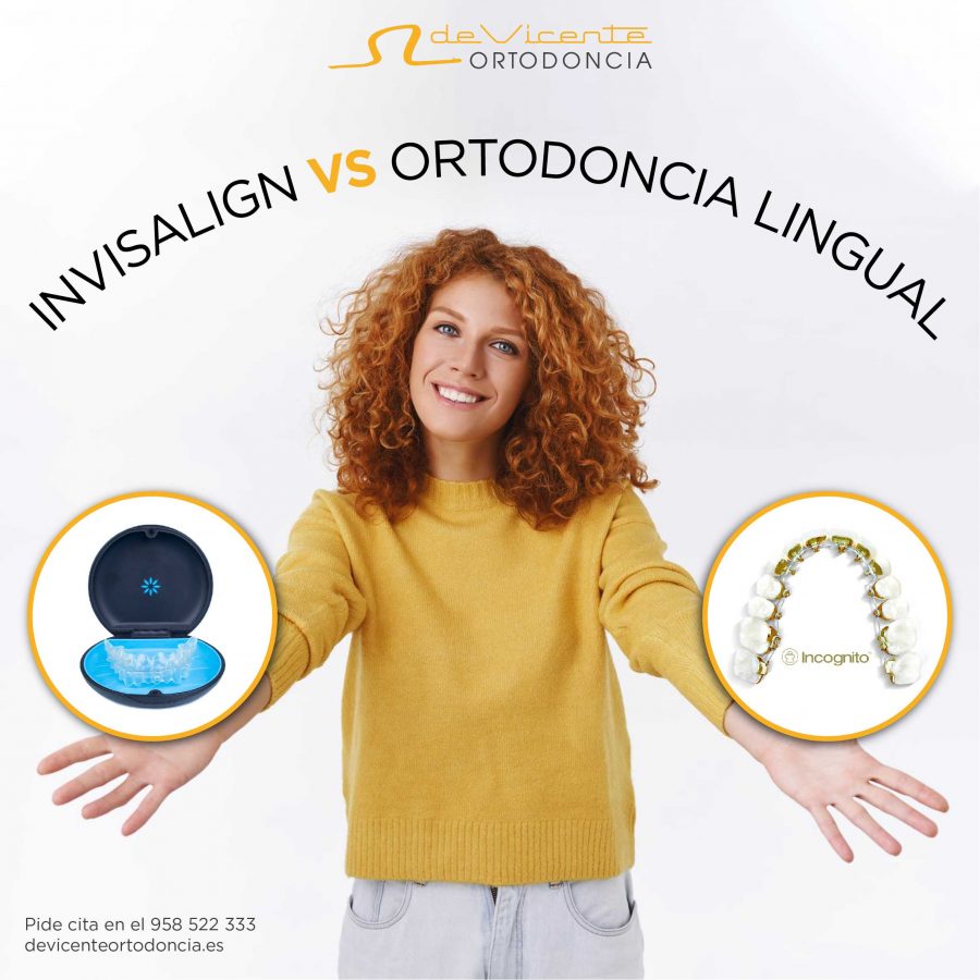 Ortodoncia lingual vs Invisalign - De Vicente Dental. Odontología ...