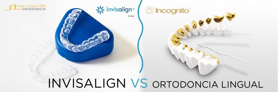 Ortodoncia lingual vs Invisalign - De Vicente Dental. Odontología ...